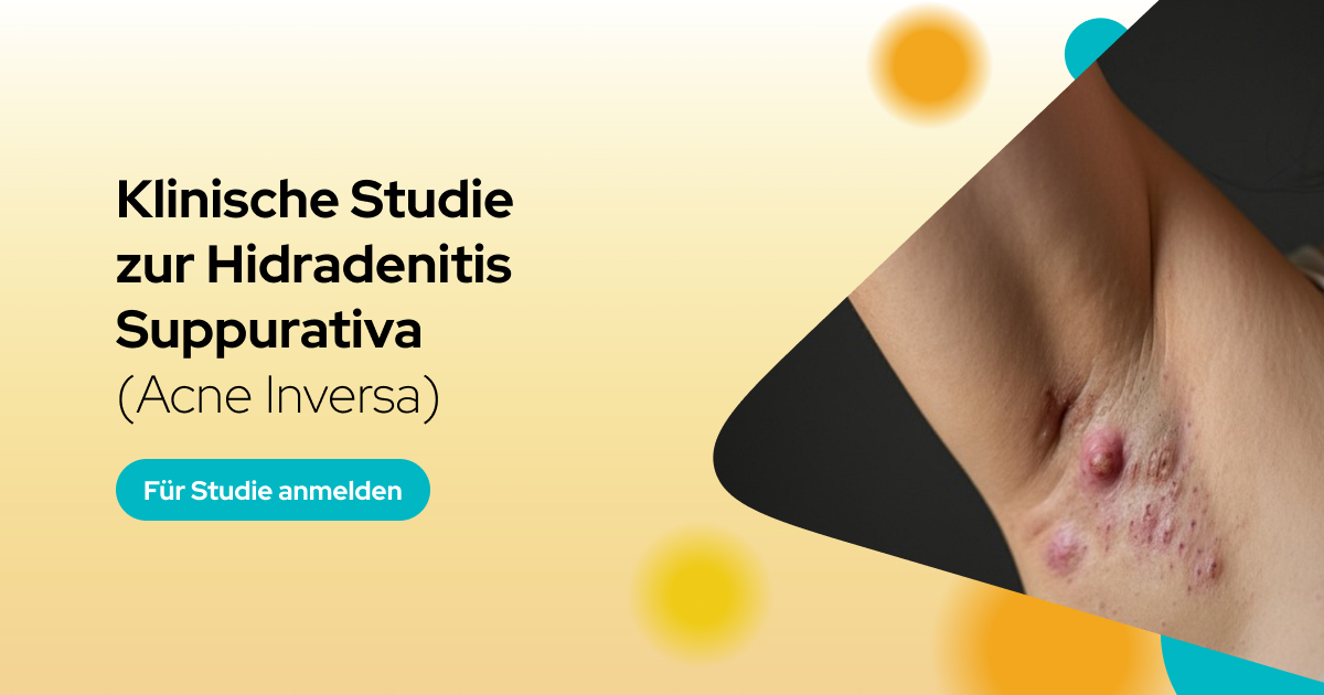 Clinical study on Hidradenitis Suppurativa – Participants wanted